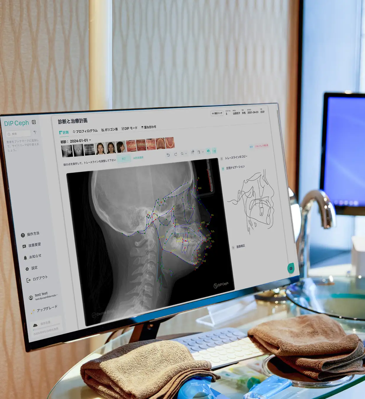 矯正治療の新時代到来！AIが支える『DIP Ceph PRO』とは？ - 東京日本橋AQUA歯科・矯正歯科包括CLINIC